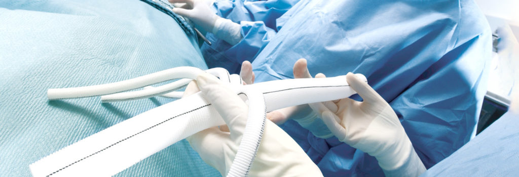 Vascular Surgery – Overview, Causes & Diagnosis | Dr. S. K. Sinha
